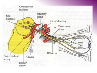 Oculomotor Nerve Pathway