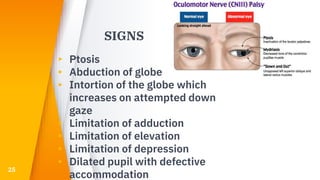 Oculomotor nerve | PPT