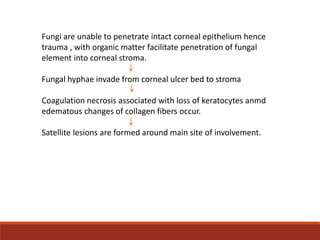 Oculomycosis modified | PPTX