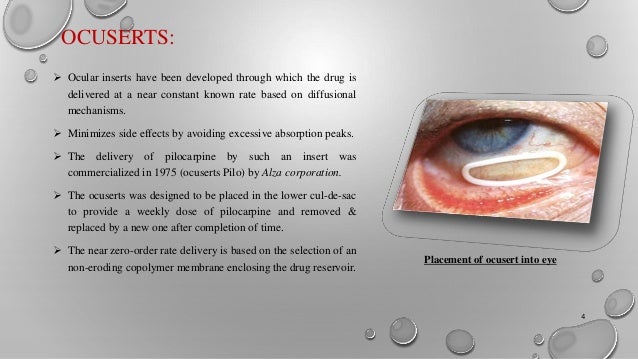FORMULATION AND EVALUATION OF OCUSERTS OF CIPROFLOXACIN HCl