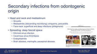 Oral diagnostics - Focal infection .pptx