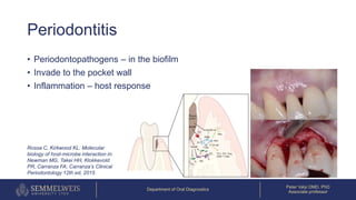 Oral diagnostics - Focal infection .pptx