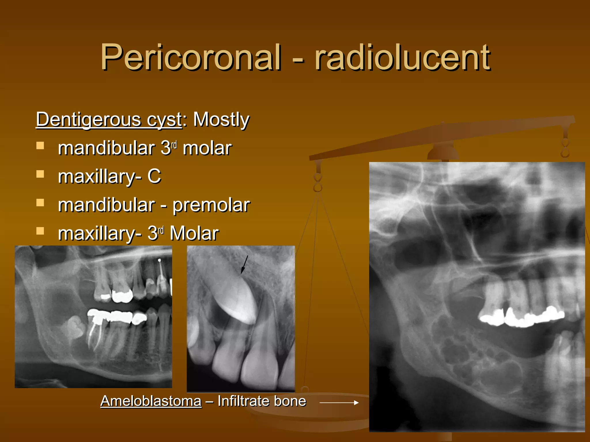 Radiographic Differential Diagnosis 2008 | PPT