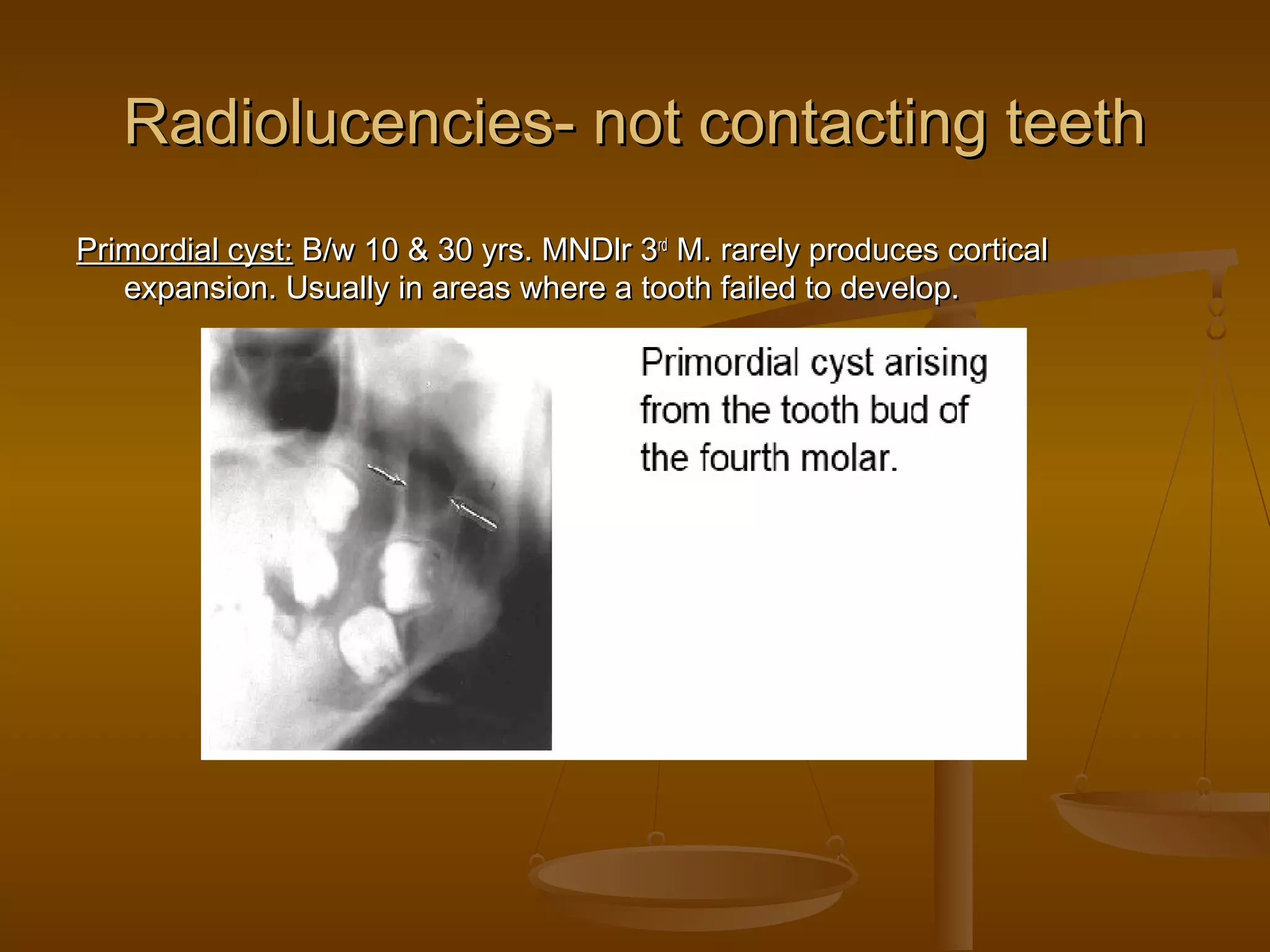 Radiographic Differential Diagnosis 2008 | PPT