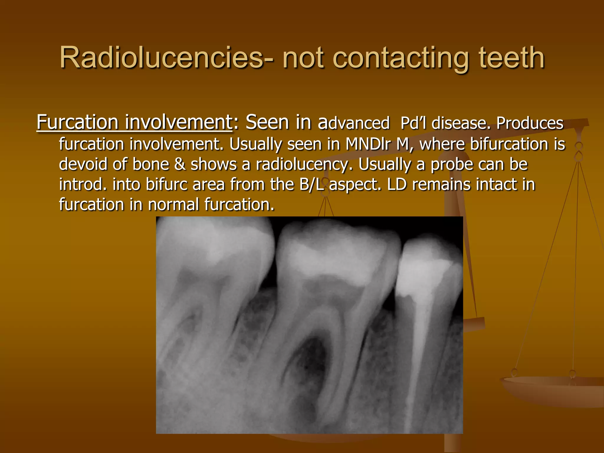 Radiographic Differential Diagnosis 2009 | PDF
