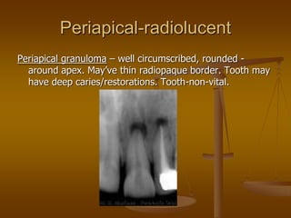 Periapical Scar
