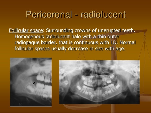 Radiographic Differential Diagnosis 2009