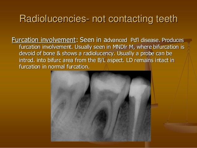 Radiographic Differential Diagnosis 2009