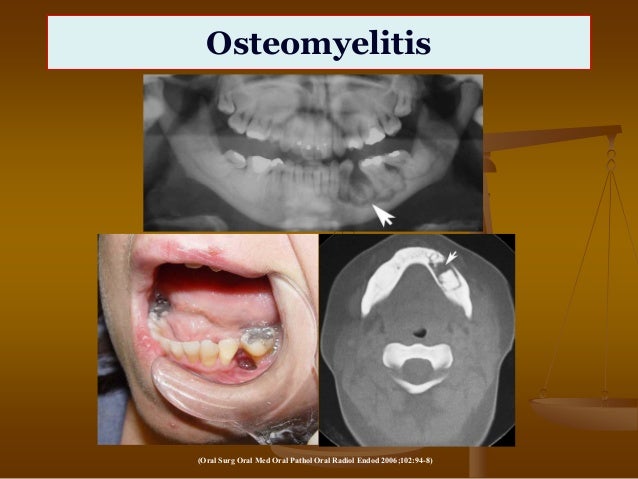 Radiographic Differential Diagnosis 2009