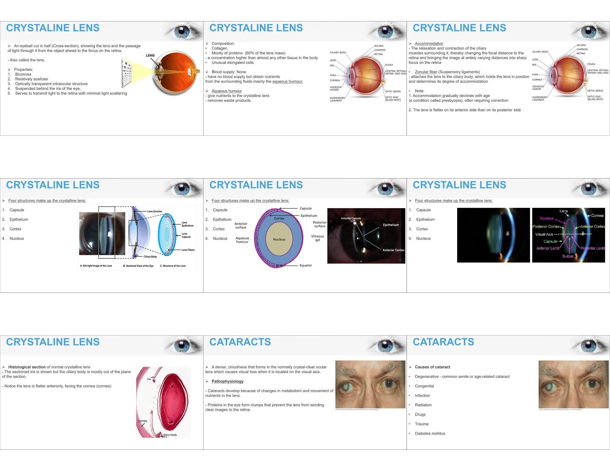 Cataract Cataract Cataract Cataract Cataract | PDF