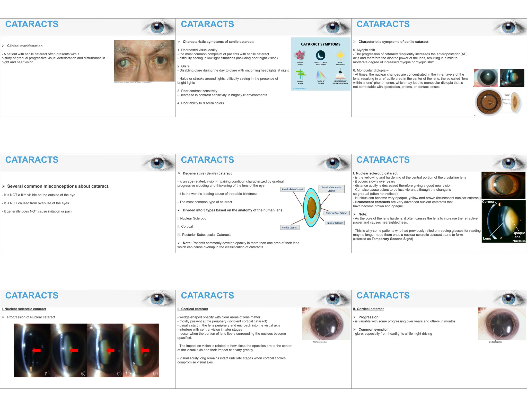 Cataract Cataract Cataract Cataract Cataract | PDF