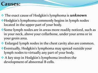 hodgkins lymphoma | PPTX