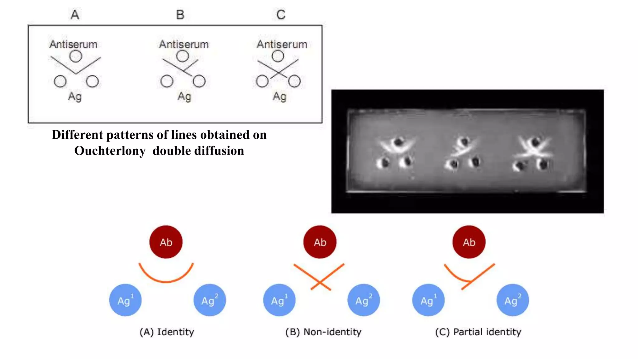 Ouchterlony double immunodiffusion | PPTX