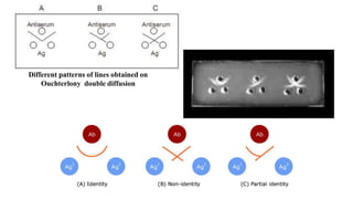 Ouchterlony double immunodiffusion