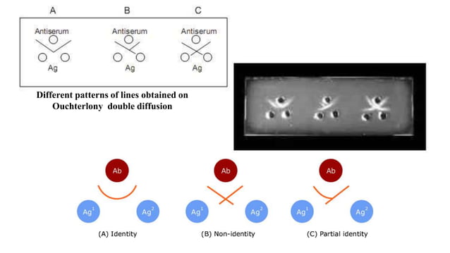 Ouchterlony double immunodiffusion