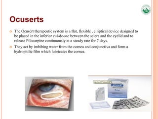 Odds ocular drug delivery system | PPT