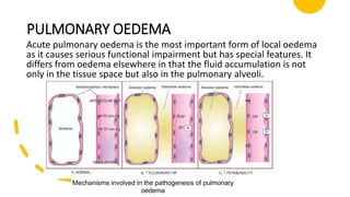 Odema | PPTX