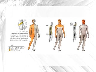 Walking disorders, muscle nerve interaction | PPT