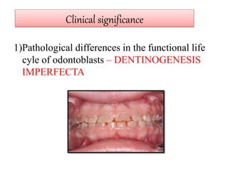 ODONTOBLAST | PPTX