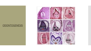 Odontogenesis | PPT