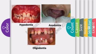 Odontogenesis and its related anomiles.pptx