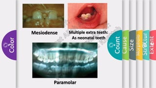 Odontogenesis and its related anomiles.pptx