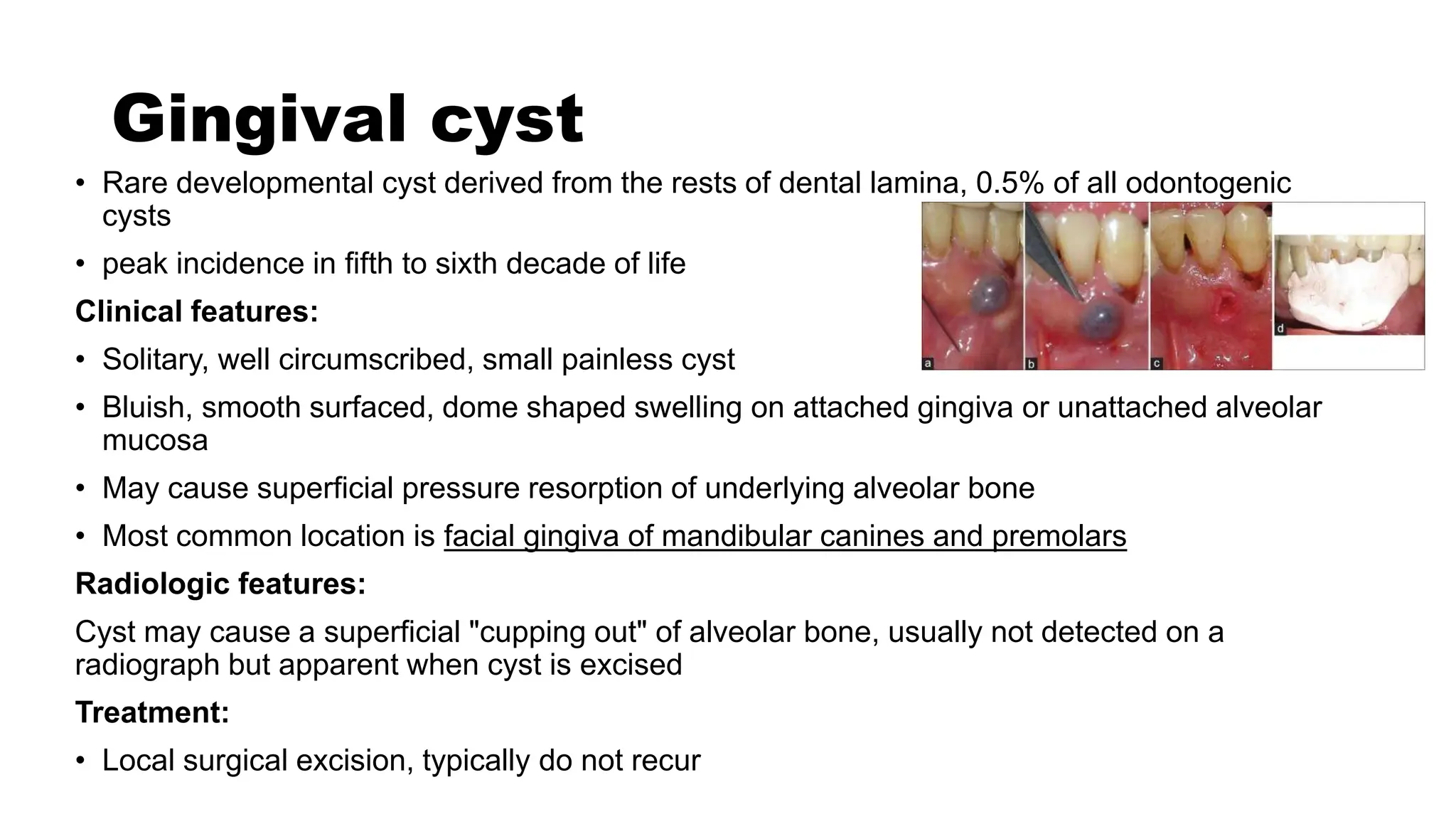 Classification and management Odontogenic cysts of oral cavity | PPTX