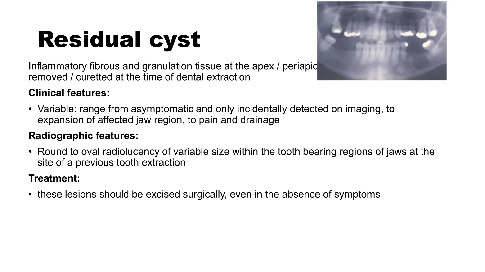 Classification and management Odontogenic cysts of oral cavity | PPTX