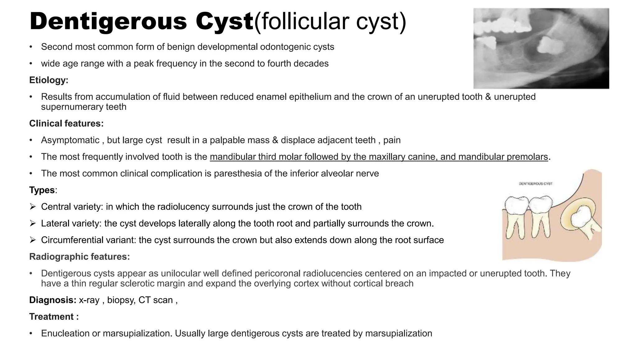 Classification And Management Odontogenic Cysts Of Oral Cavity Ppt