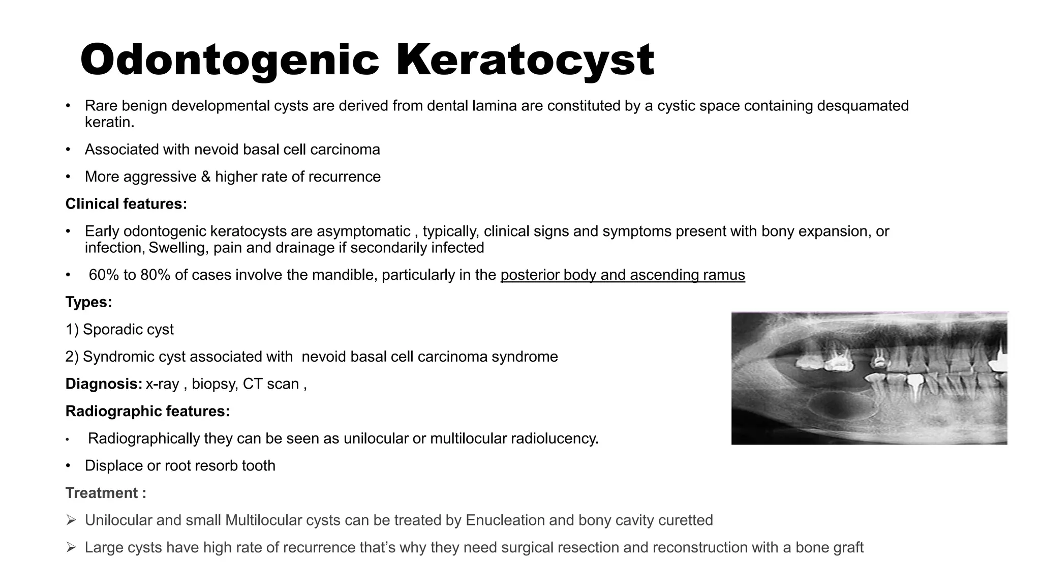 Classification and management Odontogenic cysts of oral cavity | PPTX