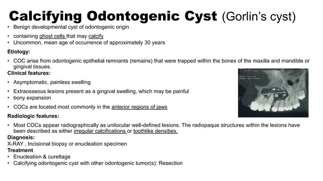 Classification And Management Odontogenic Cysts Of Oral Cavity Ppt