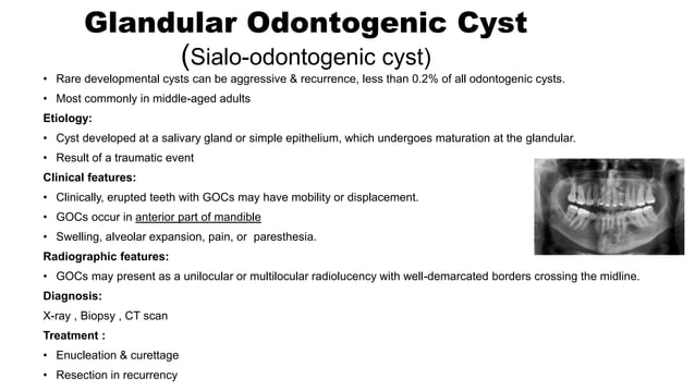 Classification and management Odontogenic cysts of oral cavity | PPTX ...