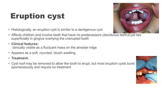 Classification and management Odontogenic cysts of oral cavity | PPTX ...