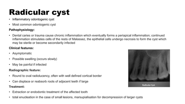 Classification and management Odontogenic cysts of oral cavity | PPTX ...
