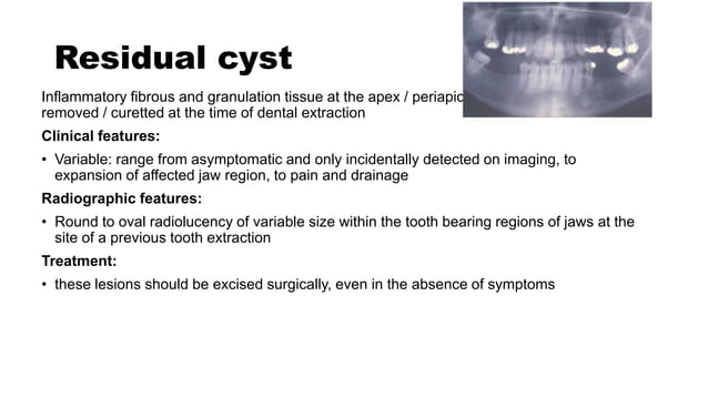 Classification and management Odontogenic cysts of oral cavity | PPTX ...