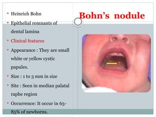 Seminar on dental Odontogenic-cysts-IV.pptx