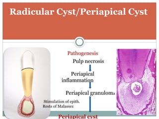 Seminar on dental Odontogenic-cysts-IV.pptx