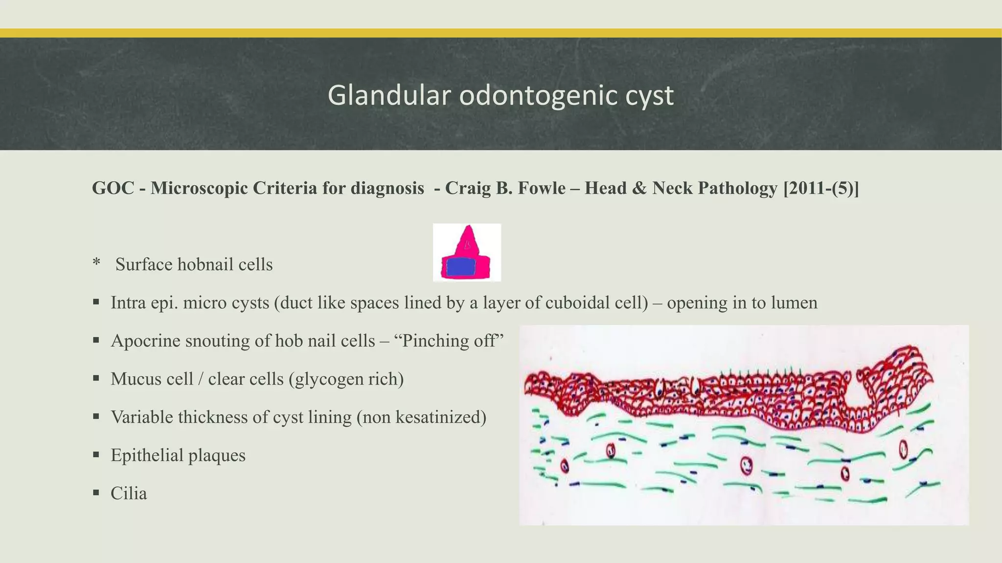 Odontogenic cyst | PPTX