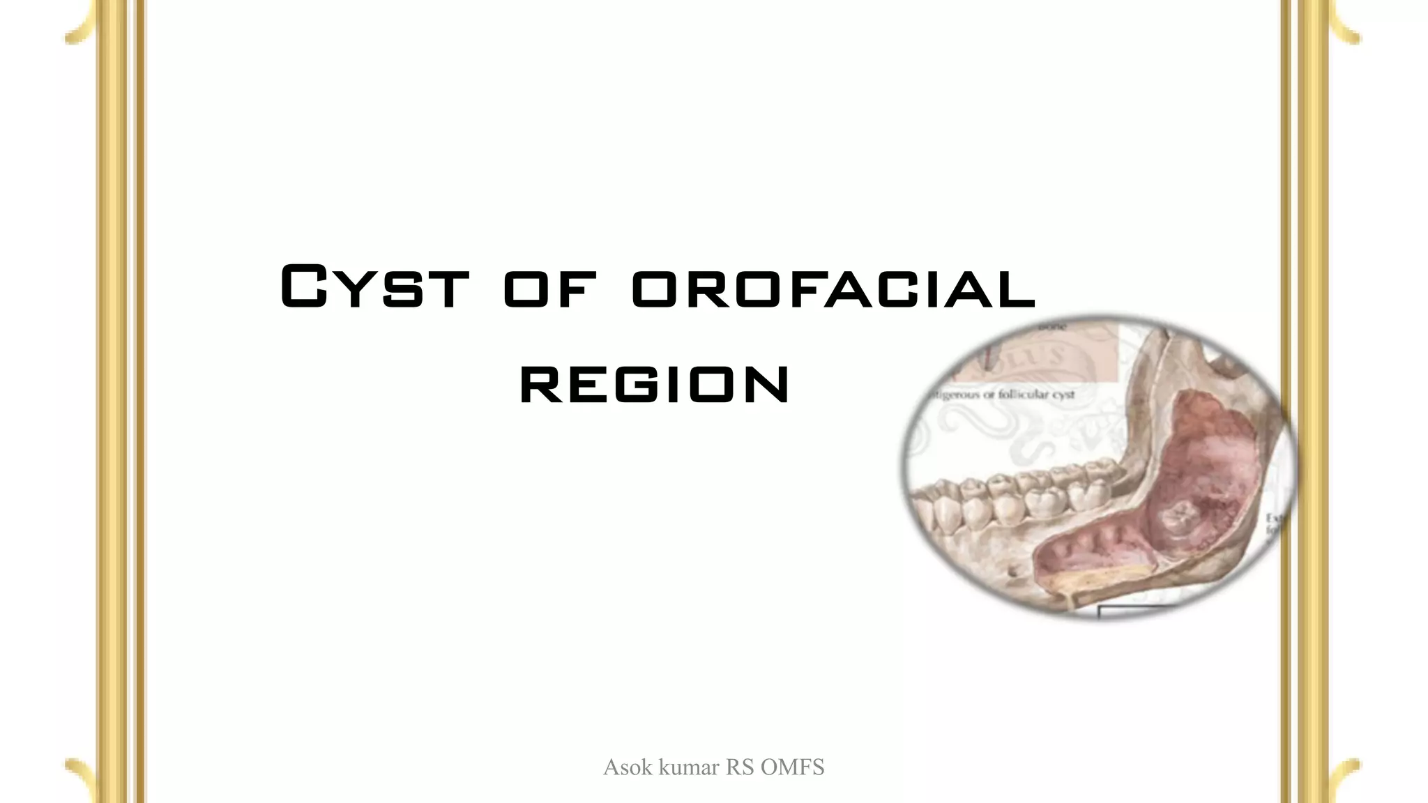 Odontogenic cyst | PDF