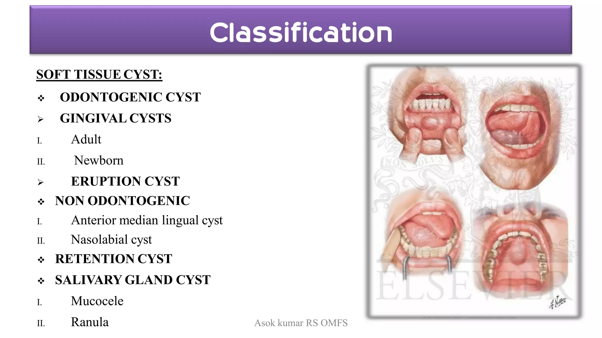 Odontogenic cyst | PDF