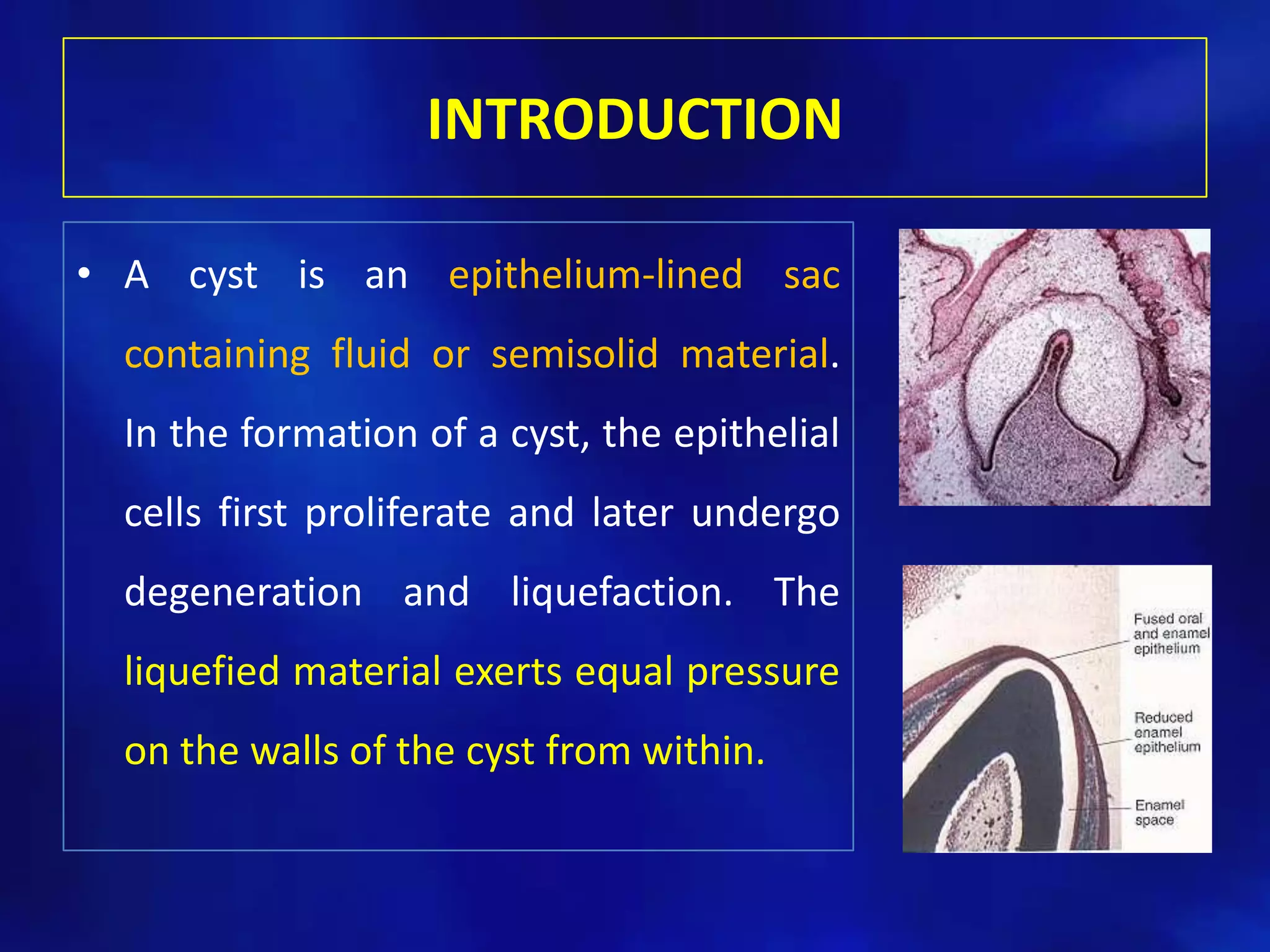 Odontogenic cysts | PPTX