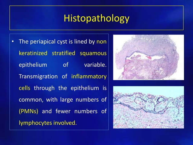 Odontogenic cysts | PPT