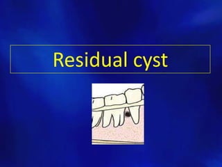 Residual Cyst Clinical