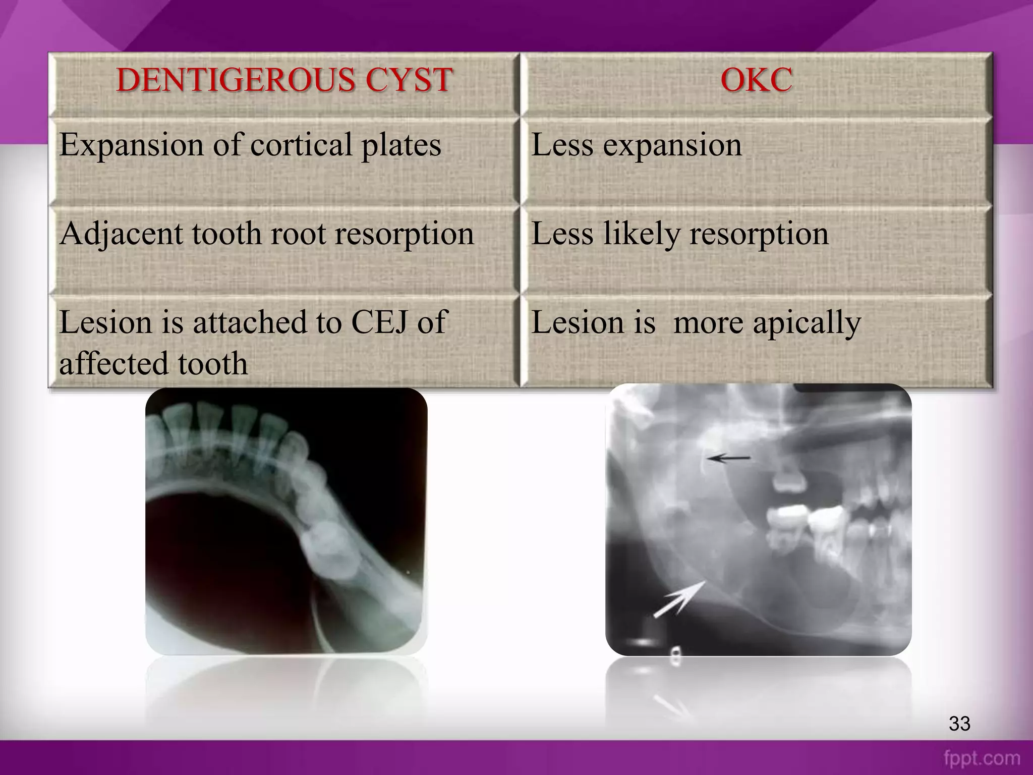 ODONTOGENIC CYSTS.pptx