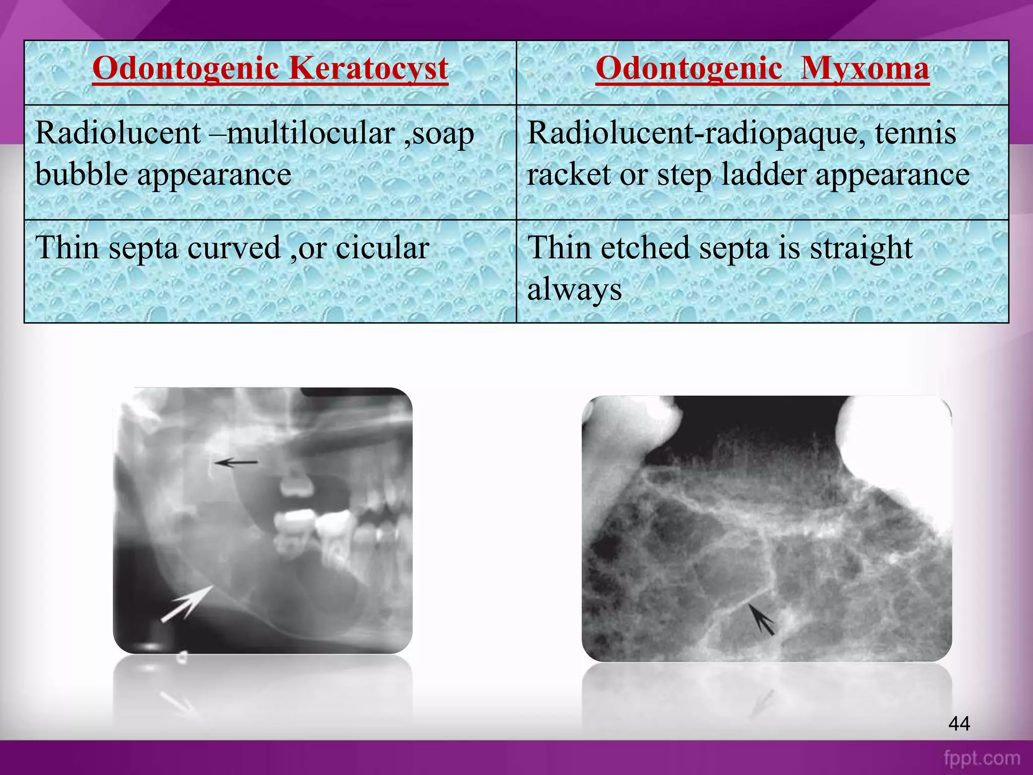 ODONTOGENIC CYSTS.pptx