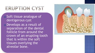Odontogenic cysts lectur presentation.pptx