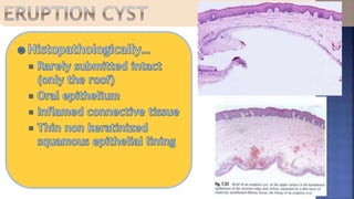Odontogenic cysts lectur presentation.pptx