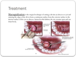 topic - odontogenic cysts and tumors.pptx