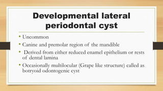 Odontogenic cyst | PPTX