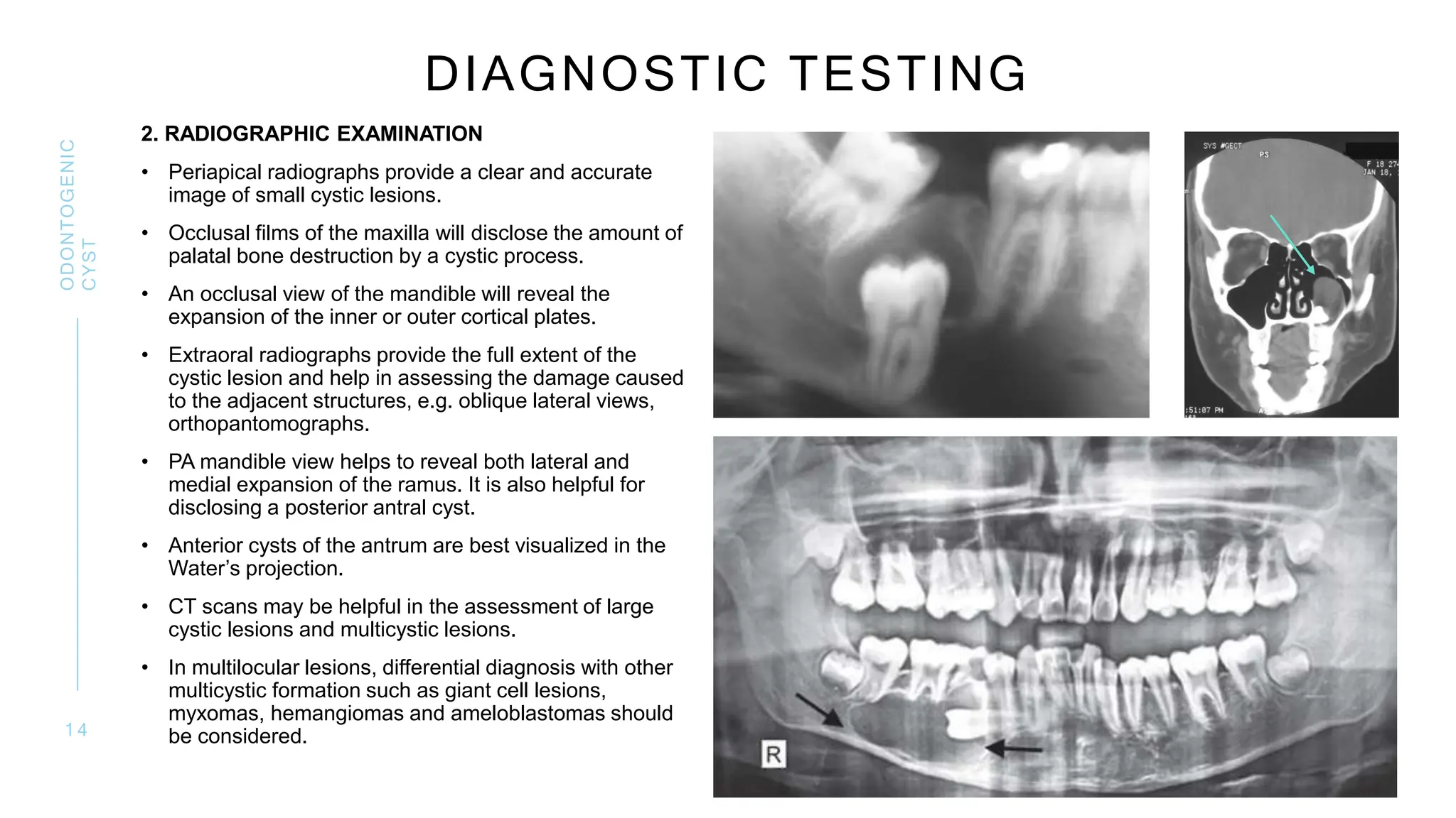 ODONTOGENIC CYSTS OF THE JAWS AND THE MANAGEMENT | PPTX